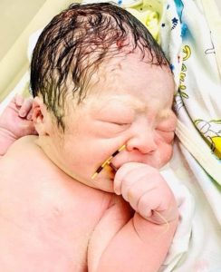 Bebê nasce segurando o DIU que sua mãe usava para evitar gravidez